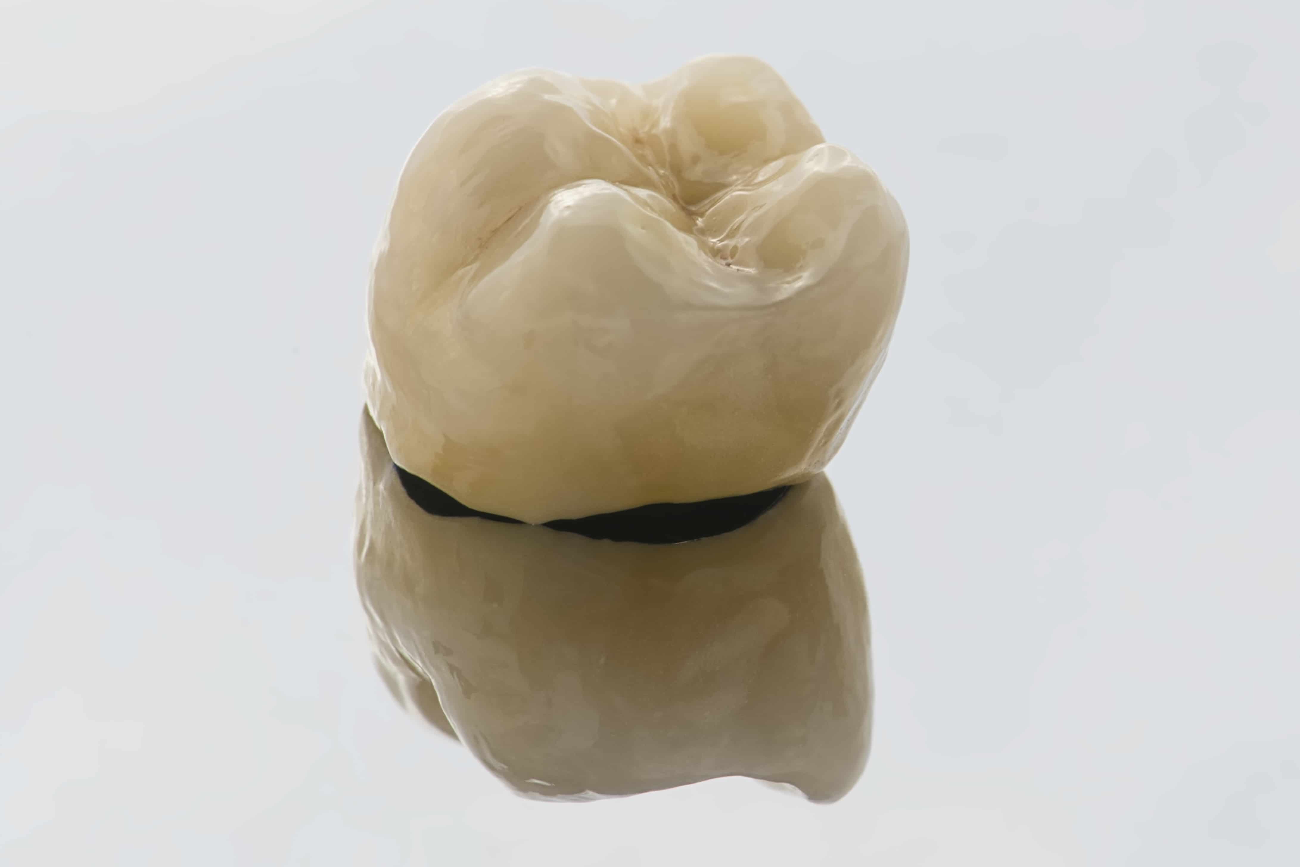 How Do You Create Natural Looking Crowns? | Richfield, MN