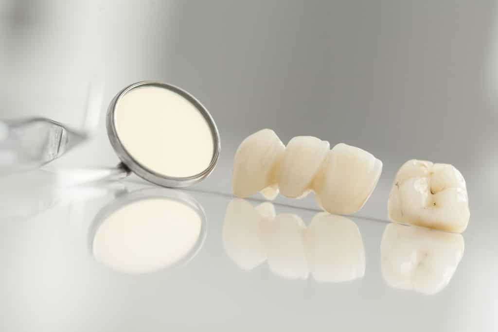 Richfield Dentist Creates Natural Looking Crowns | Richfield, MN