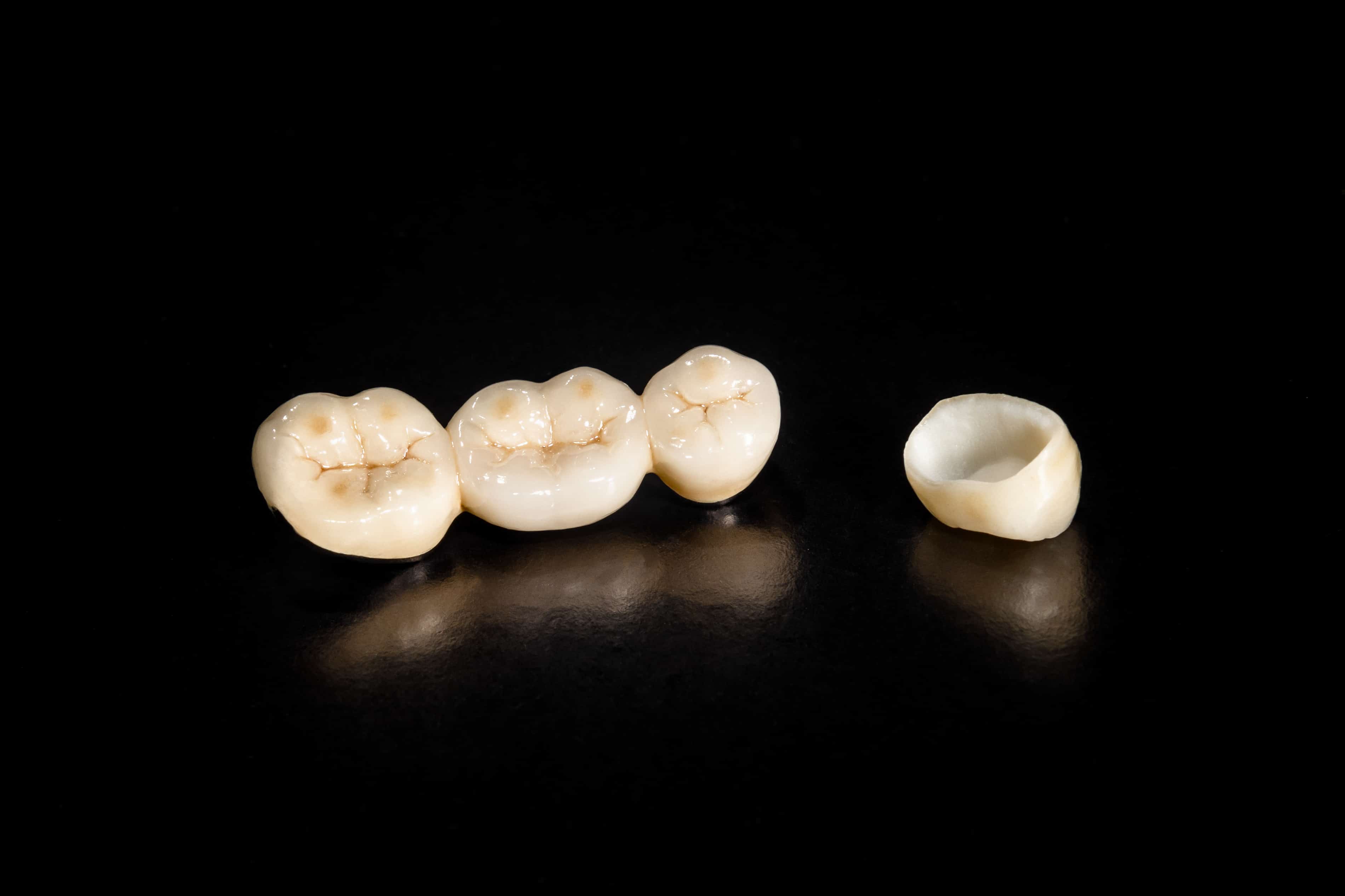 Richfield Dentist Offers Dental Bridges That Look Natural | Richfield, MN