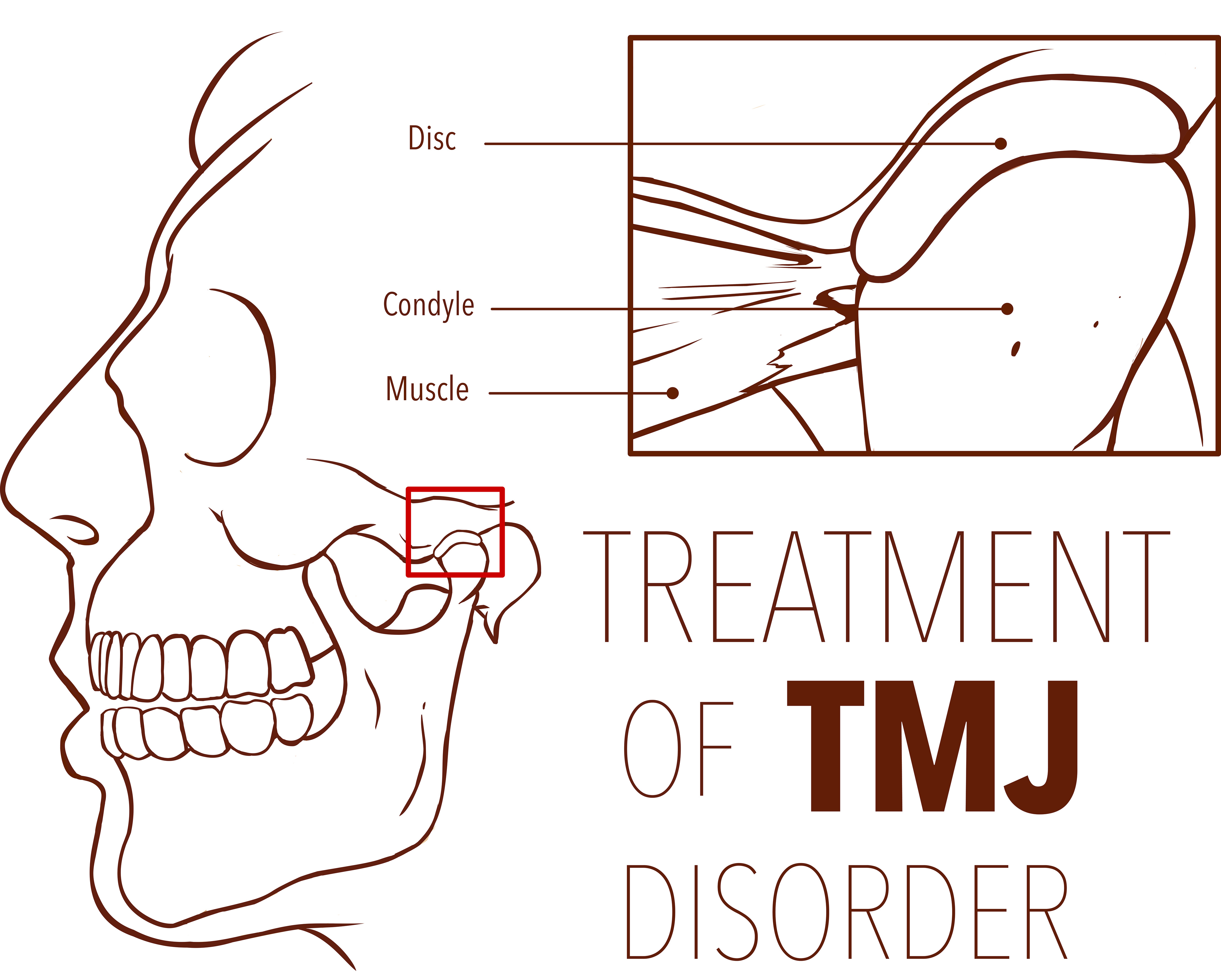 When Does A Smile Need Tmj Treatment Richfield Mn