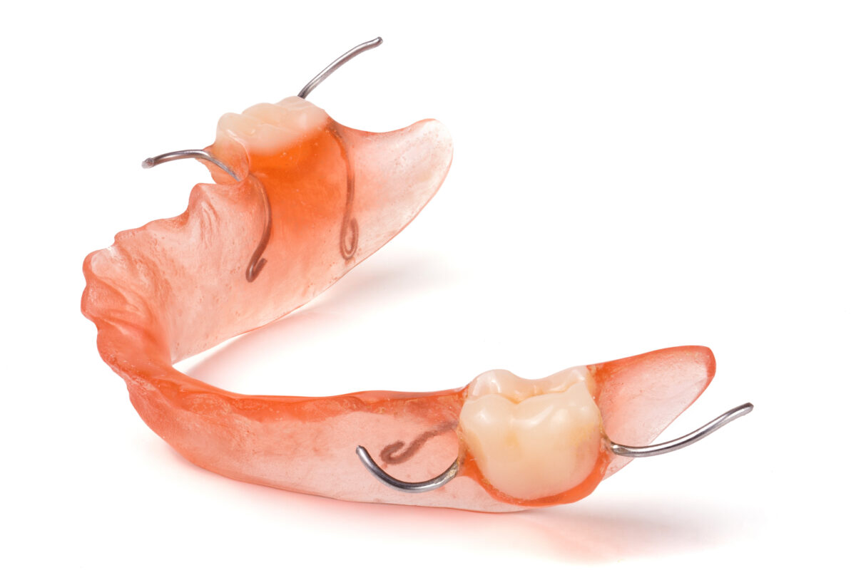 Using Partials To Rebuild Your Smile | Richfield, MN