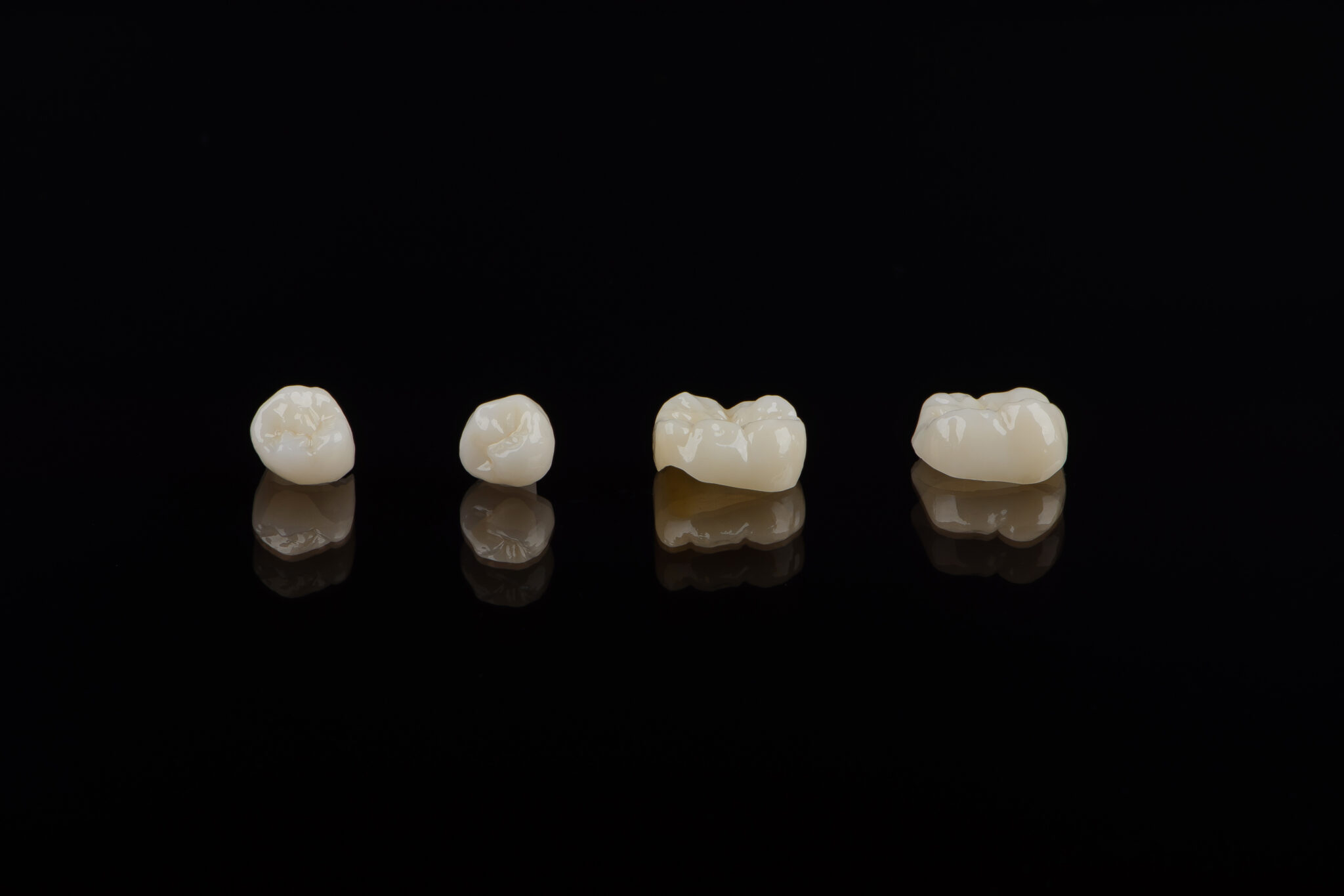 Creating Crowns From Attractive Materials | Richfield, MN